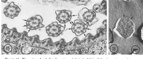 figure 15 from ciliary membrane differentiations in tetrahymena