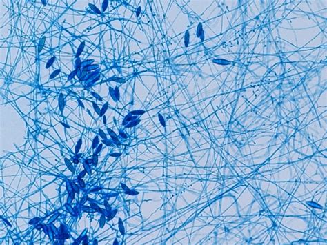 Fun With Microbiology Whats Buggin You Microsporum Gypseum