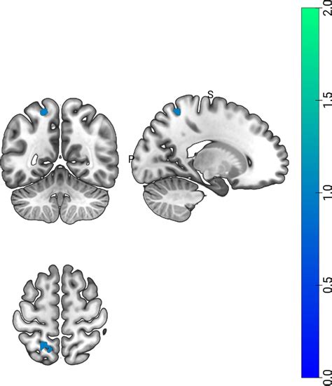 Results Of The Contrast Analysis Between Arrow And Gaze Cueing