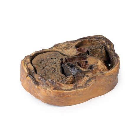 Thoracic Cross Section At T6 Australian Physiotherapy Equipment