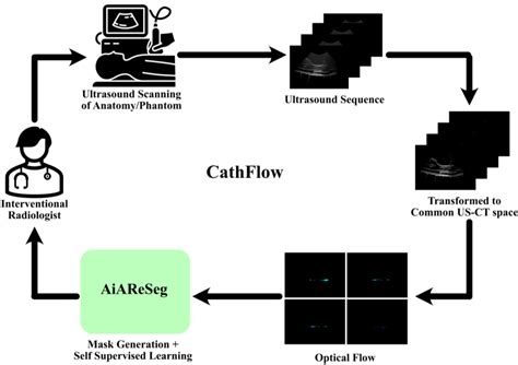 论文审查 Cathflow Self Supervised Segmentation Of Catheters In Interventional Ultrasound Using