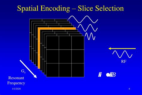 Ppt Mri Physics Principles And Applications Powerpoint Presentation