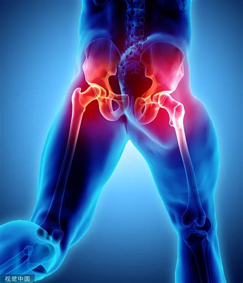 人体三维 3d 各种痛 透视骨骼 盆骨痛 花瓣网