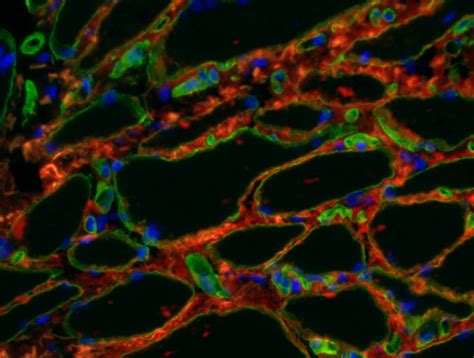 Angiogenesis Analyzer For Imagej Gilles Carpentier Research Web Site