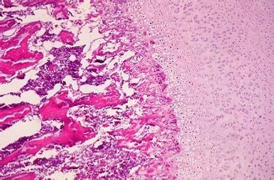 Bone Histology Bone Histology Slide