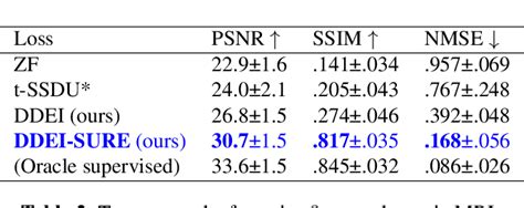 Fully Unsupervised Dynamic Mri Reconstruction Via Diffeo Temporal