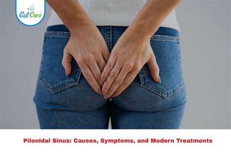 What Is A Pilonidal Sinus And How Is It Treated