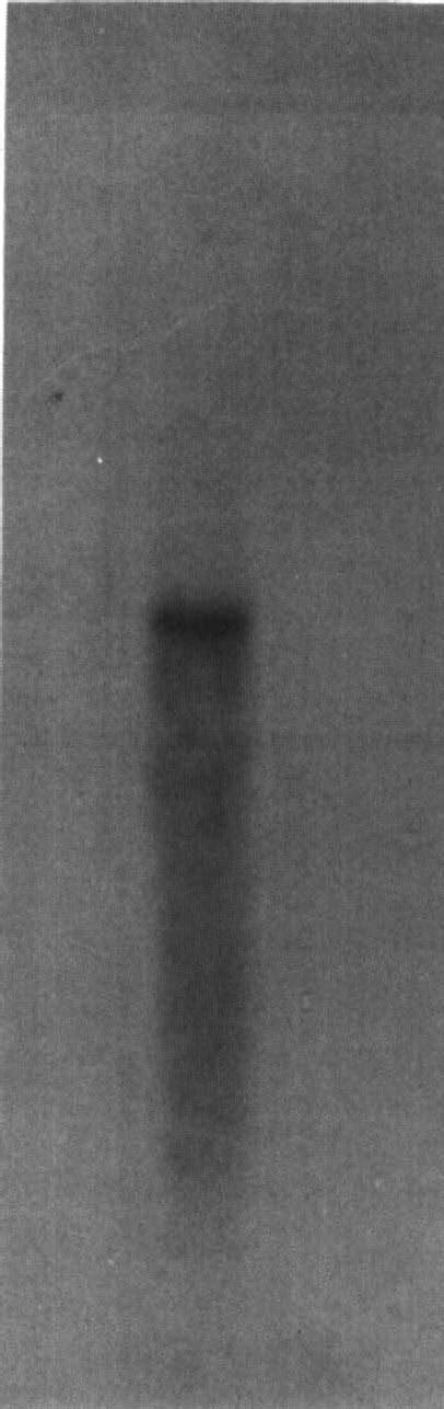 Rna Blot Hybridization With A Phosphodiesterase Specific Probe Download Scientific Diagram