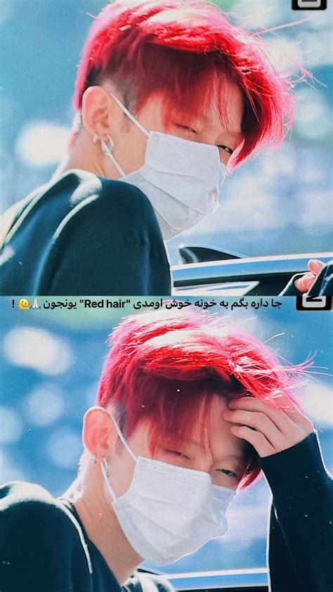 پای یونجون آسیب دیده و موهاش رو هم قرمز کرده، بله یه سری لینک عکس