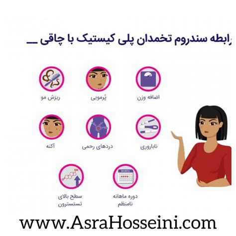 سندرم پلی کیستیک و ریزش مو آکادمی اسرا حسینی