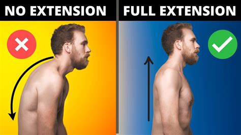 Extension Definition Health At Erin Patteson Blog