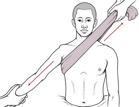 Dislocated Shoulder Symptoms Causes Treatment And Recovery