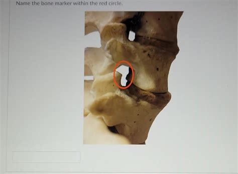 Solved Name The Bone Marker At The Tip Of The Arrow Name