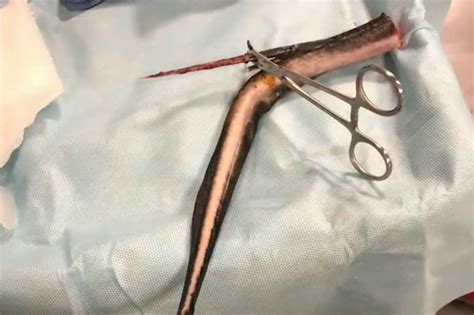 Florida Woman Kristie Cataffo Obrien Impaled By Super Painful