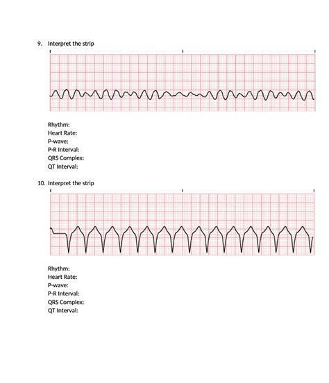 Solved Interpret The Strip Rhythm Heart Rate P Wave Chegg Com