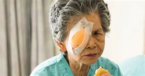 A Comprehensive Guide To Extracapsular Cataract Extraction