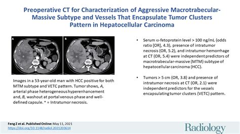 Preoperative Ct For Characterization Of Aggressive Macrotrabecular Massive Subtype And Vessels