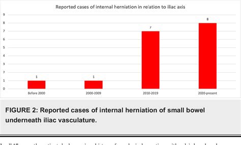 Figure 1 From Internal Herniation Of Small Bowel Underneath Iliac