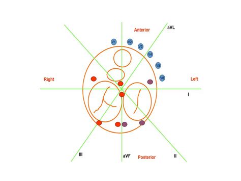 Localization Of Wpw Accessory Pathway By Surface Ecg Pptx