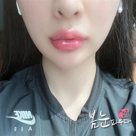 봄눈피우다의원 내 얼굴과 조화를 이루는 입술 디자인💋 6월 봄눈 입술필러 서포터즈 모집🎉 ⠀ 6월