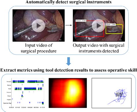 Figure 1 From Tool Detection And Operative Skill Assessment In Surgical Videos Using Region