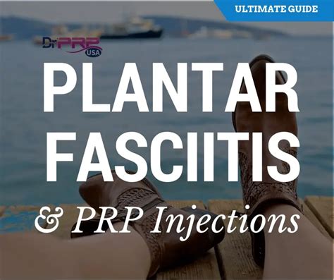 PRP Injection For Plantar Fasciitis The Ultimate Guide