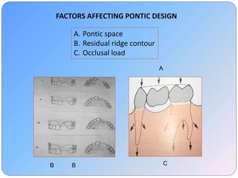 Esthetics In Fpd Pptx Dental Health Diseases And Conditions