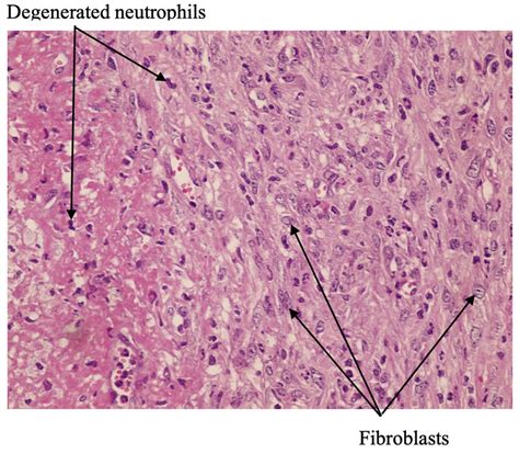 2 Biological Control Necrotic Tissues And A Large Number Of Download Scientific Diagram