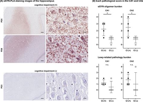 α Synuclein αsyn Oligomers In The Hippocampus In Patients With Or Download Scientific Diagram