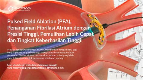 Pulsed Field Ablation Pfa Inovasi Revolusioner Dalam Pengobatan Fibrilasi Atrium