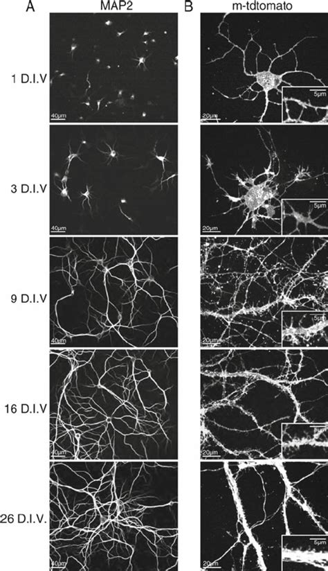 Development Of Dendrites And Spines Of Postnatal Hippocampal Neurons Download Scientific