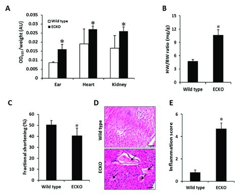 Ec Specific Mcpip Deletion Enhances Vascular Permeability Cellular