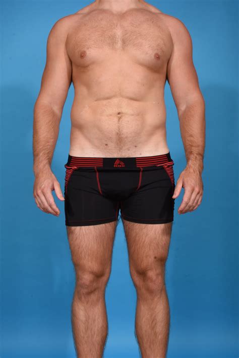 Abdominal Etching With High Definition Liposculpting Sculpt Aesthetic
