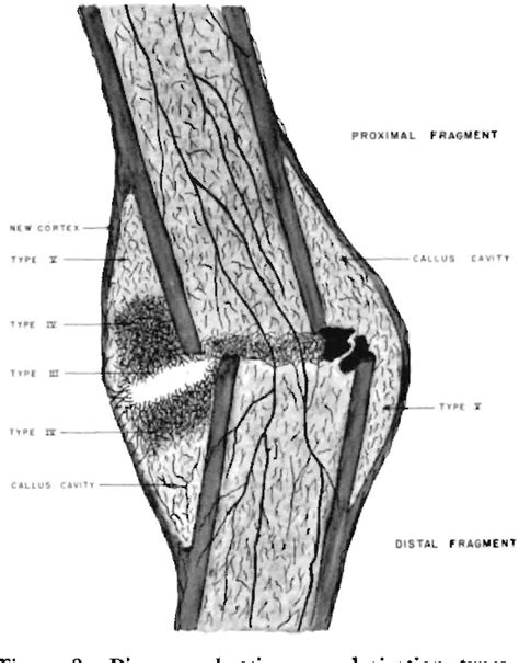 Figure 2 From Bone Vascularization And Its Effec T On Fracture Healing