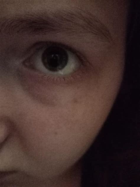 Am I The Only One With Huge Pupils Eyes