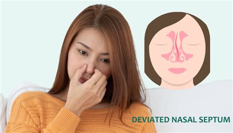 Understanding Deviated Nasal Septum Dns And Septoplasty By Dr