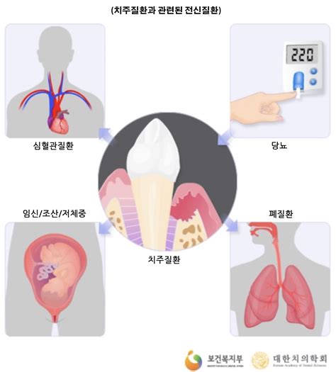 치주치료 장안동 보스톤치과의원