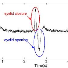 The Five Frequency Bands Of EEG Signal Download Scientific Diagram