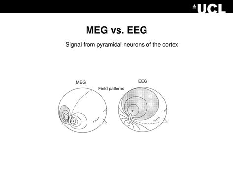 PPT EEG MEG Experimental Design Preprocessing PowerPoint Presentation ID 1907667