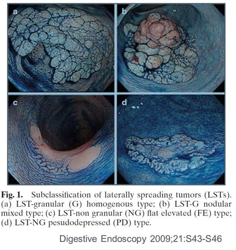분류법 Classifications Endotoday 이준행