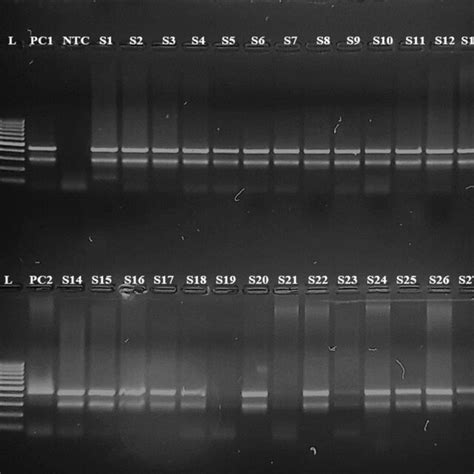 Visualization Of Results Of Multiplex Polymerase Chain Reaction One