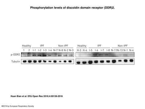 Phosphorylation Levels Of Discoidin Domain Receptor Ddr2 Ppt Download