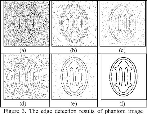Figure 3 From A Contextual Based Hopfield Neural Network For Medical Image Edge Detection