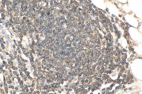 Slamf6 Antibody 22711 1 Ap Proteintech 武汉三鹰生物技术有限公司