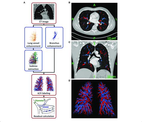 Flowchart Of The Fully Automatic Arteryvein Separation Algorithm Download Scientific Diagram