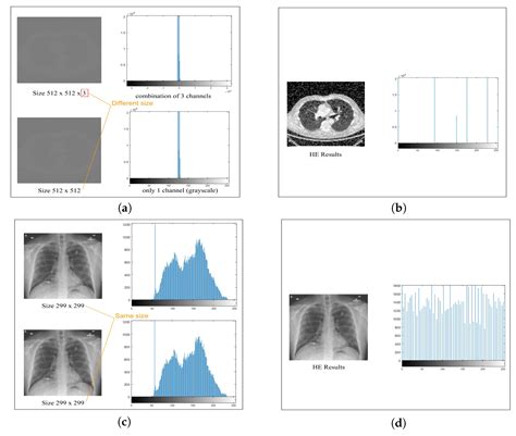 applied sciences free full text advanced medical image segmentation