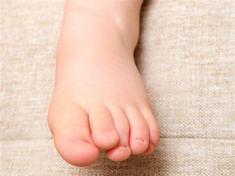 Toe Deformities Zerosole