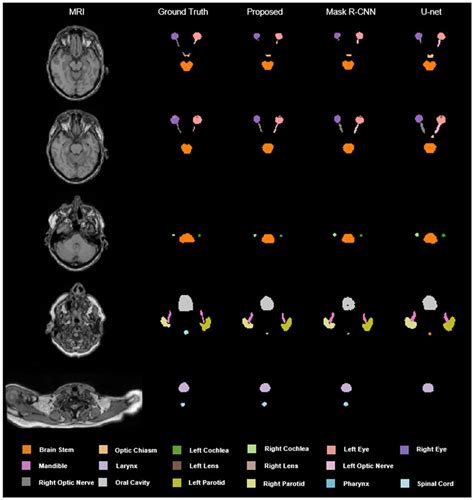 Illustrative Example Of The Segmentation Achieved By Our Proposed