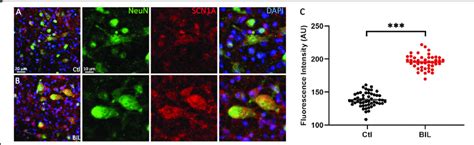 Bil Elevated The Expression Level Of Scn1a In Mvn Neurons A B Download Scientific Diagram