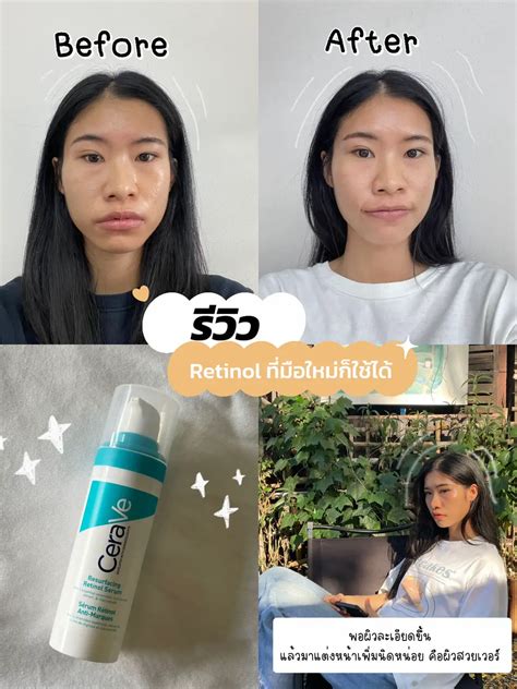 Retinol ที่จริงใจ ทำให้ผิว Glass Skin มือใหม่แนะนำมาก แกลเลอรีที่โพสต์โดย Jahmhom Lemon8